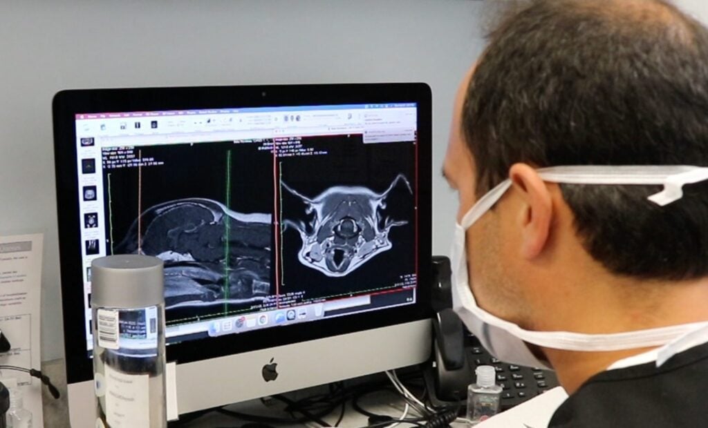 Masticatory Muscle Myositis, Trigeminal Neuritis, and Trigeminal Nerve ...